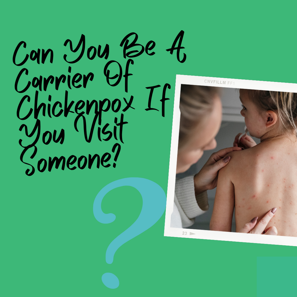 Understanding Chickenpox Transmission: Can You Be A Carrier? | RiiRoo ...