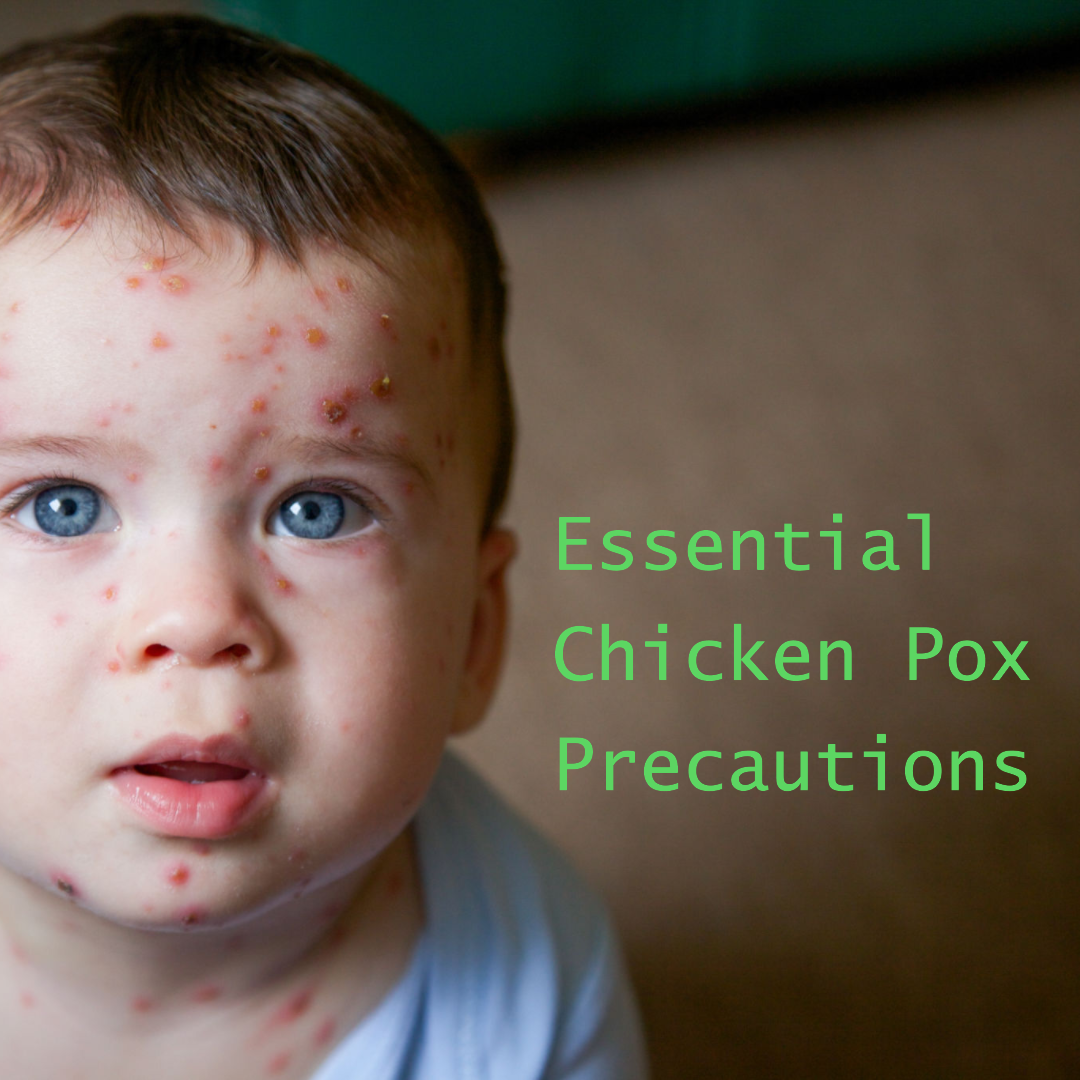 Chicken Pox On Toddlers Face